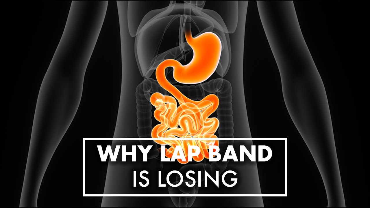Why Lap Band is Losing | Dr. Jeremy Parcells | Top10MD - YouTube