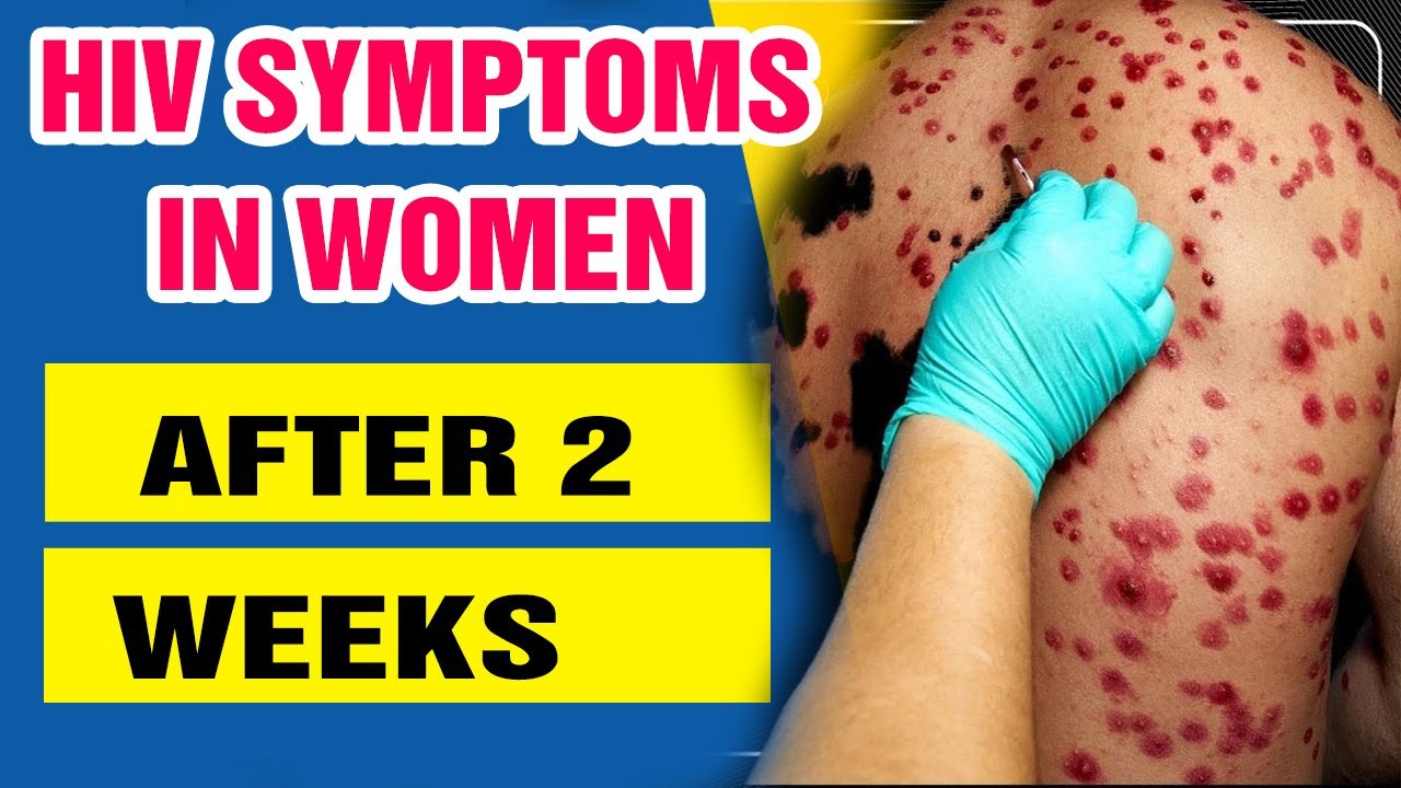 8 Early Signs of HIV in Women, How Do You Know if a Woman Has HIV - YouTube