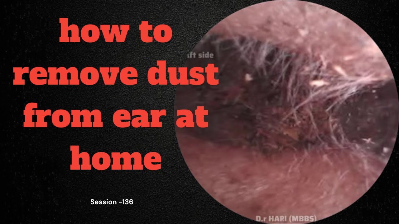 how to remove dust from ear at home || session -136 - YouTube
