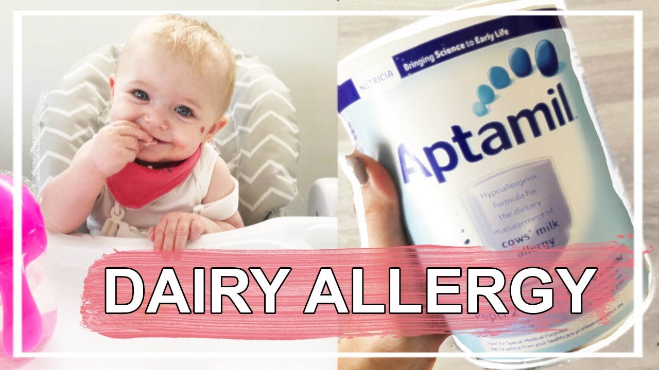 DIAGNOSED WITH A DAIRY ALLERGY SYMPTOMS DIAGNOSIS AND PLAN YouTube diagnosed-with-a-dairy-allergy-symptoms-diagnosis-and-plan-youtube