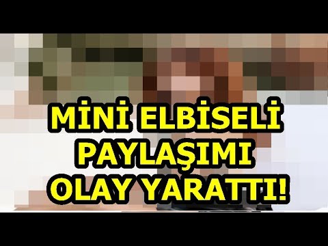 Ünlü Oyuncu Mini Elbiseli Paylaşımıyla Nefesleri Kesti!