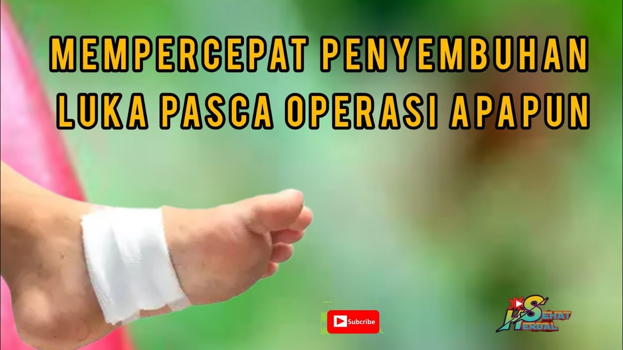 Untuk Mempercepat Penyembuhan Luka Pasca Operasi - YouTube