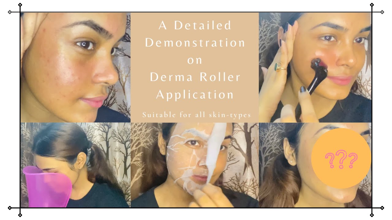 The Magic Of Derma Roller + Hot Water Steam | See the transformation ...