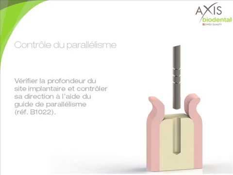 Procédure chirurgicale implant AXIS Hexalobe - protocole transgingival ...