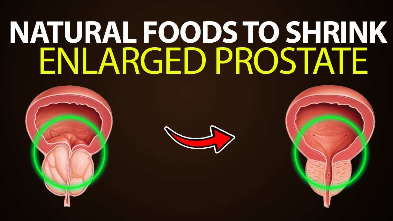 Unlock Prostate Health: Natural Foods That Actually Work - YouTube