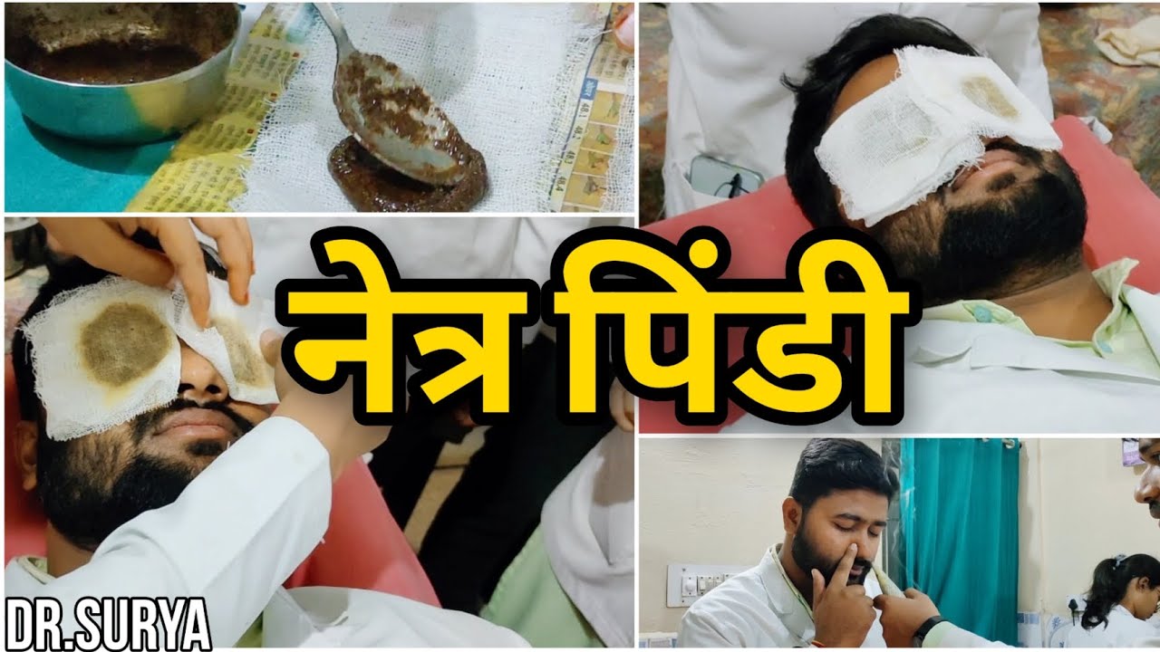 Netra Pindi | Traditional Ayurvedic eye therapy | Shalakya tantra # ...