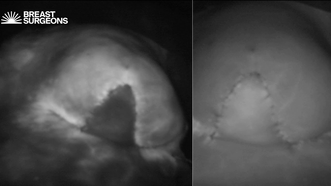 The "Bat Wing" Flap - YouTube