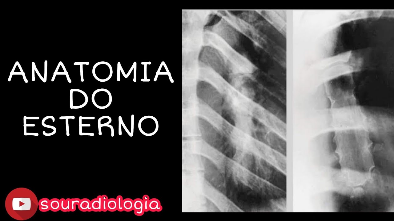 Anatomia do esterno (Radiologia) - YouTube