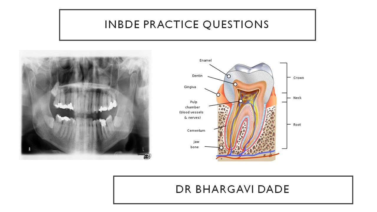 INBDE Practice Q N A - YouTube