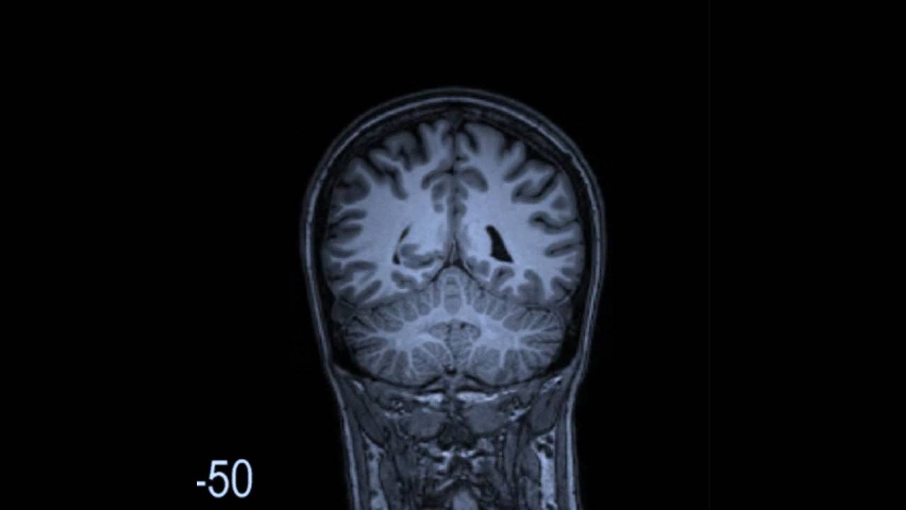 All slices from a structural MRI - YouTube