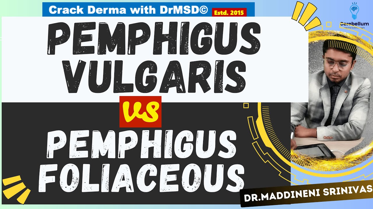 Pemphigus foliaceous Vs Pemphigus vulgaris Explained by a DERMATOLOGIST ...