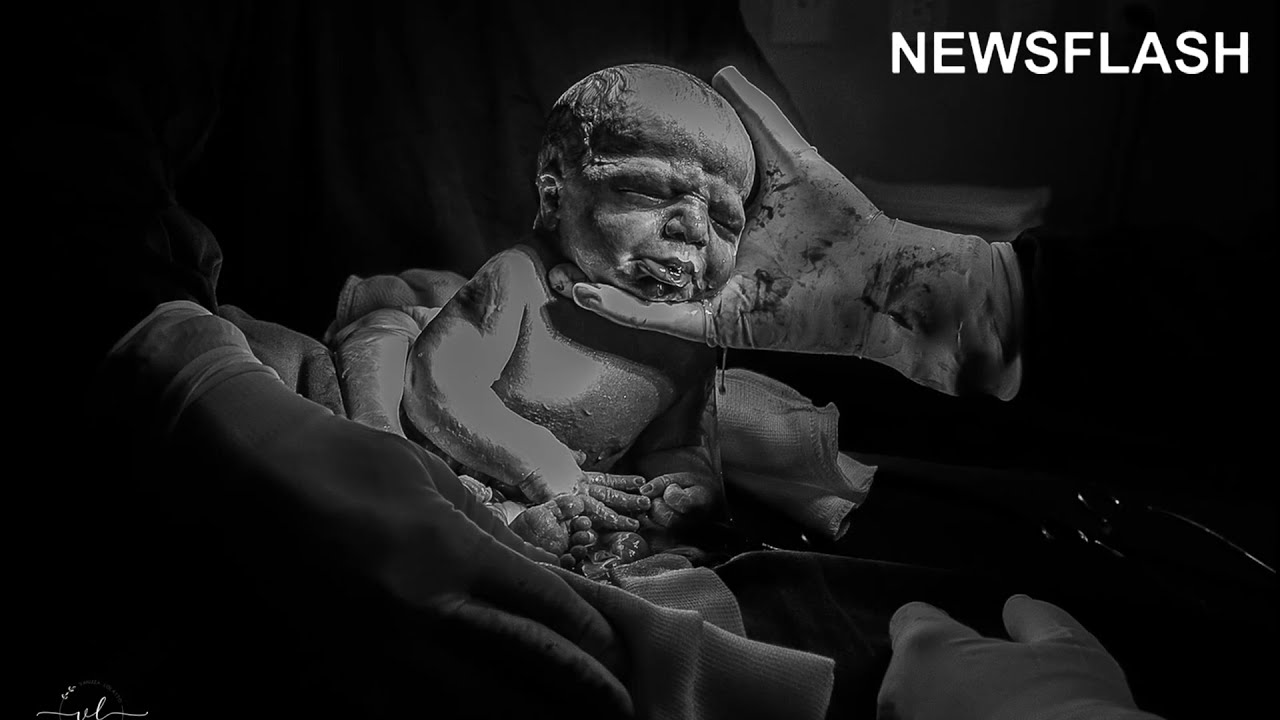 Incredible Professional Photos Show Baby Born In Amniotic Sac In ...