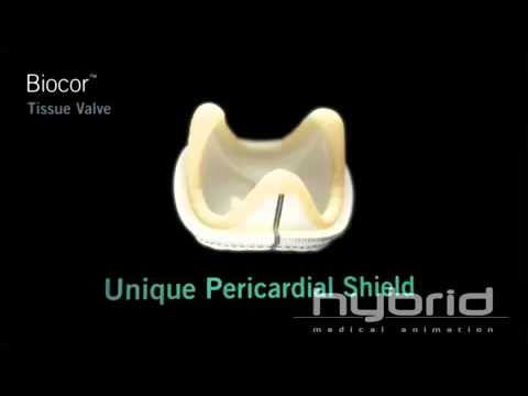 Biocor Valve Durability Animation - YouTube