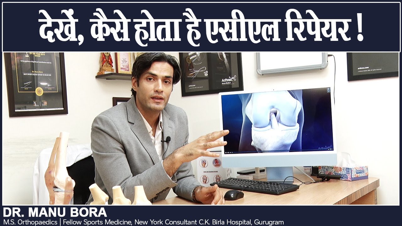 देखें, कैसे होता है एसीएल रिपेयर ! || #acl Surgery || Dr. Manu Bora ...