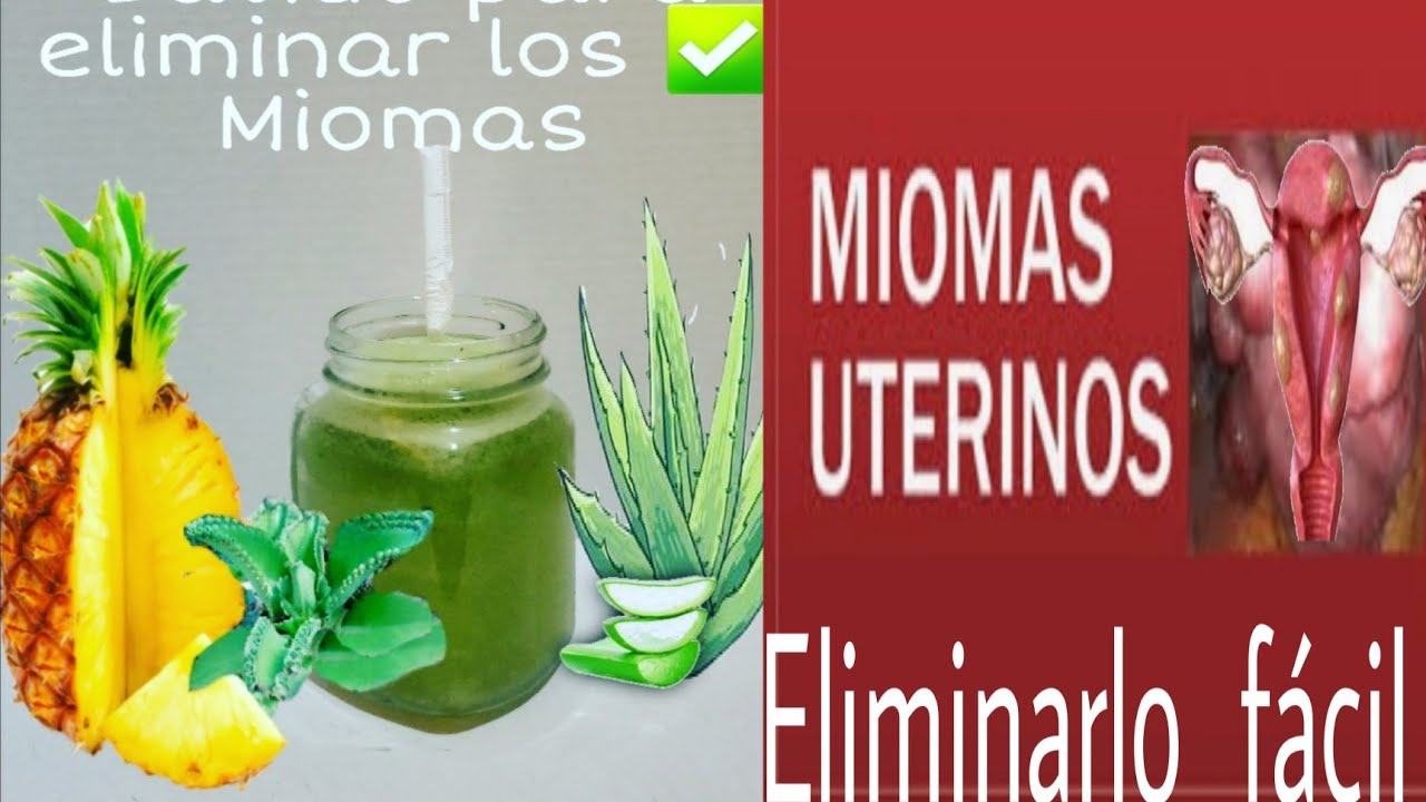 Elimina los miomas con 3 ingredientes facil - YouTube