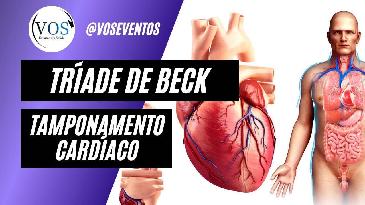Tríade de Beck | Tamponamento Cardíaco - YouTube