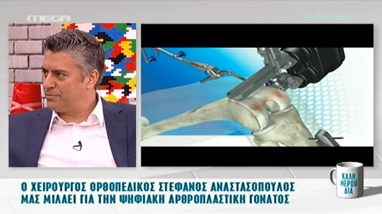 Ψηφιακή Ολική Αρθροπλαστική Γόνατος - YouTube