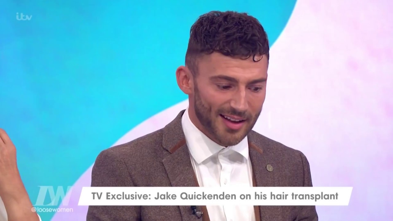 Jake Quickenden opens up about his hair transplant at KSL Clinic - YouTube