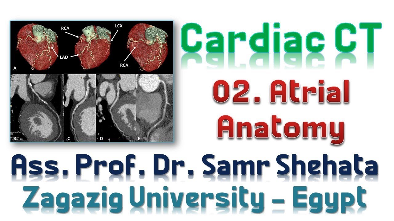 Cardiac CT (2) ... Atrial Anatomy - YouTube