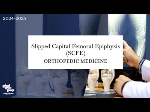Slipped Capital Femoral Epiphysis , Ortho Medicine , Lec 10 - YouTube
