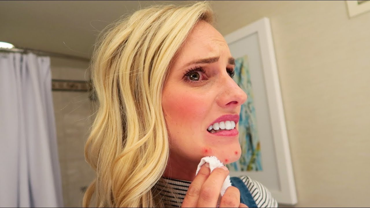MY FACE IS BREAKING OUT YouTube my-face-is-breaking-out-youtube