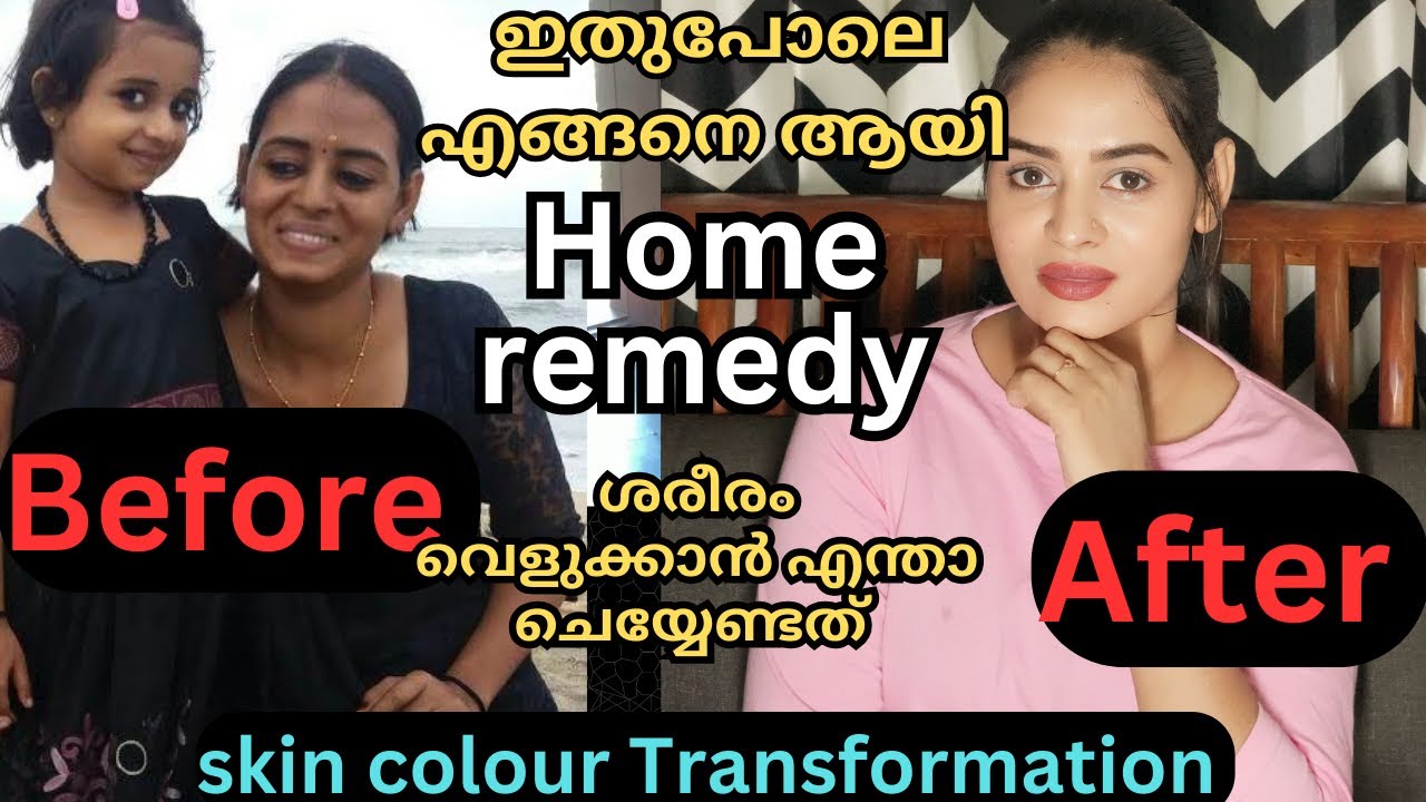 ‼️എങ്ങനെ ആണ് skin colour transformation ആയത് |വെളുക്കാൻ എന്താ ചെയ്തത് ...