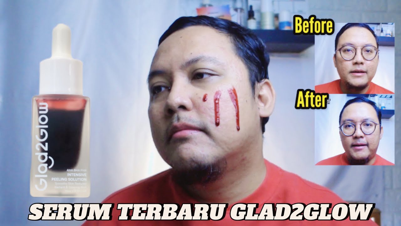 REVIEW + CARA PAKAI GLAD2GLOW PEELING SOLUTION - YouTube