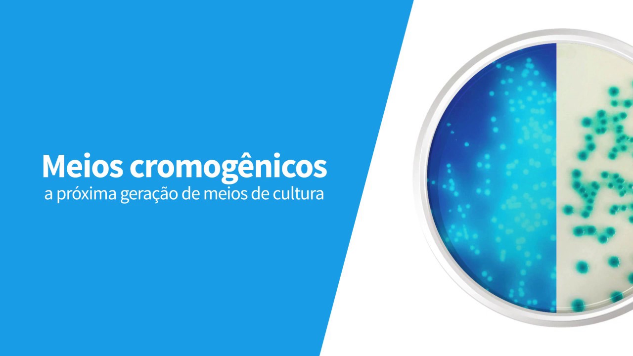 Lab de A a Z: Meios Cromogênicos - YouTube