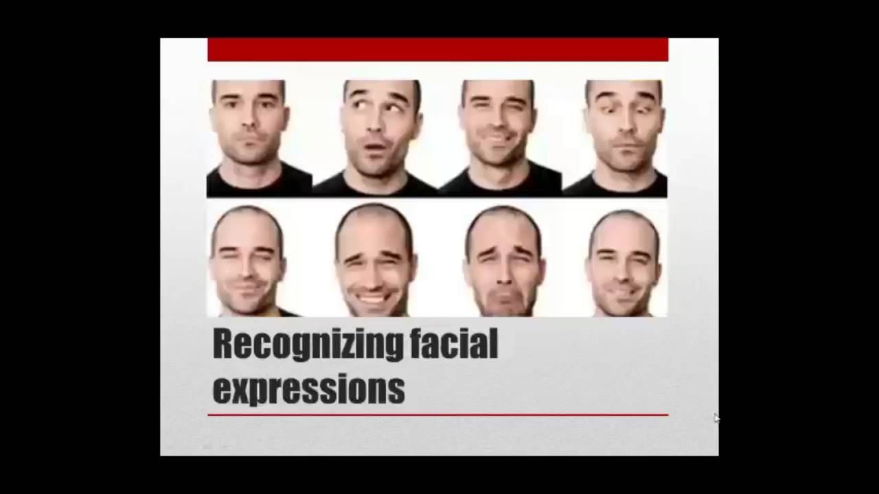 2016 CARES - Glaucoma's Impact on Quality of Life - Marlene Moster, MD ...