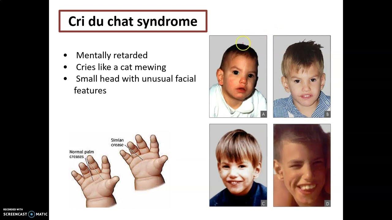 LECTURE CHAPTER 7 MUTATION PART 6 - YouTube