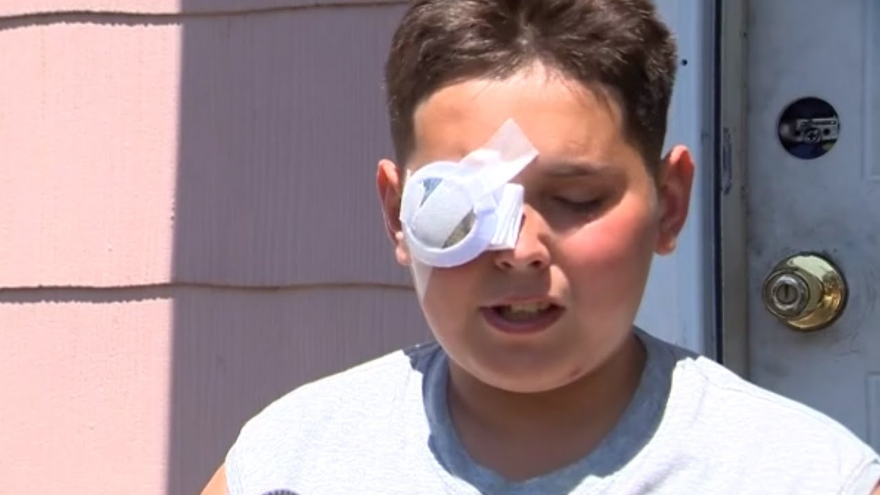 12-year-old hit in eye by drive-by paintball shooting in Massachusetts ...