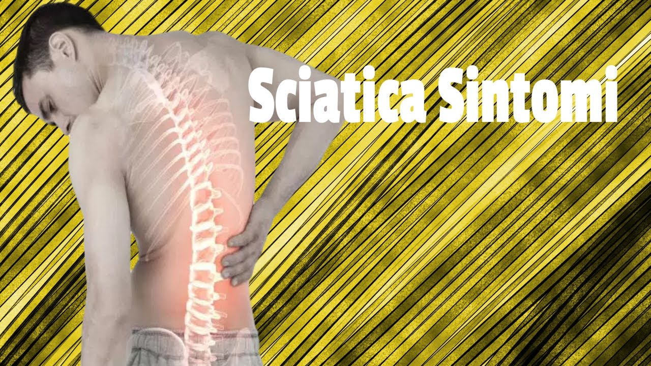 Sciatica Sintomi, Nervi Sciatico, Come Curare La Sciatica In Modo ...