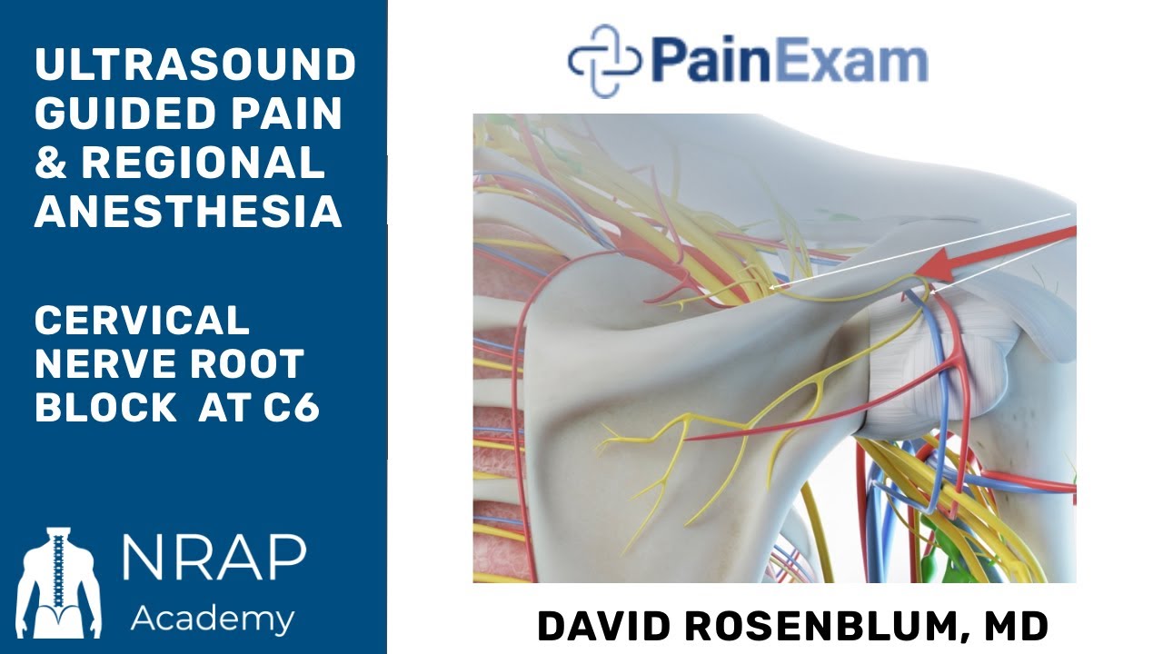 Ultrasound Guided Suprascapular Nerve Block & Ultrasound Exam of the ...
