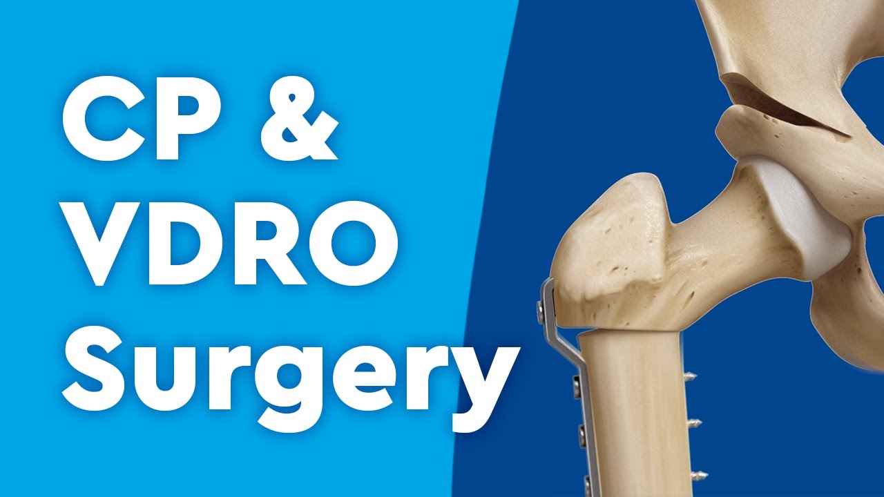 About Cerebral Palsy and VDRO Surgery to Improve Mobility - YouTube