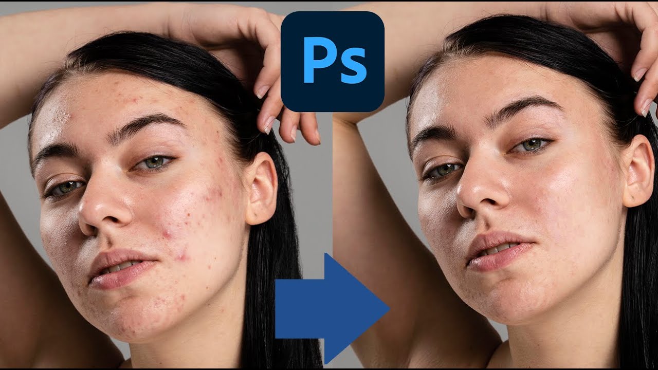 Pimple Removal in 1 Minute: Free Photoshop Tips and Tricks Tutorial for ...