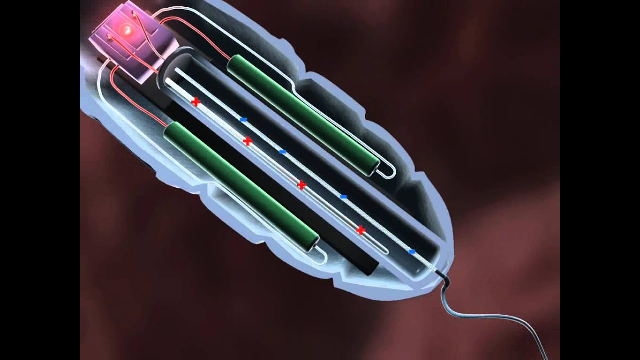 Twisting Artificial Muscles - YouTube