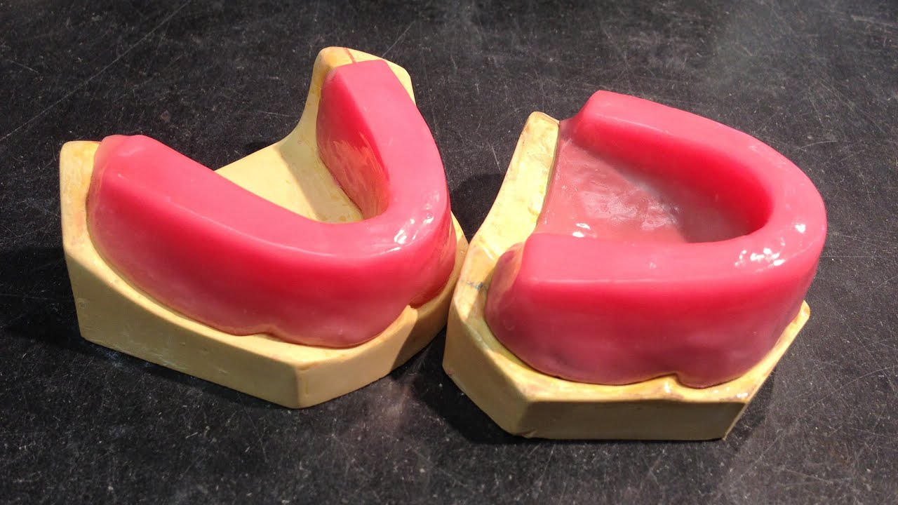 upper bite rim part 1 - YouTube