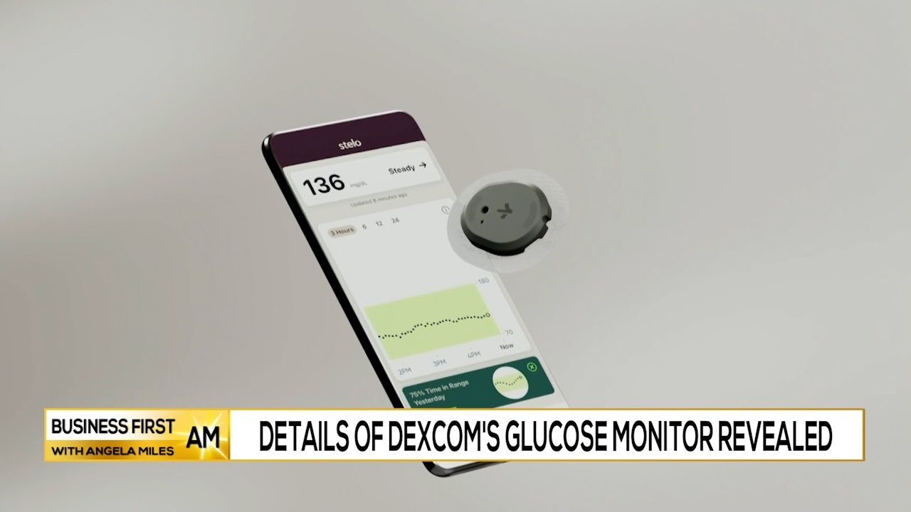 Scott Checks Up On Chart Of Dexcom (DXCM) - YouTube