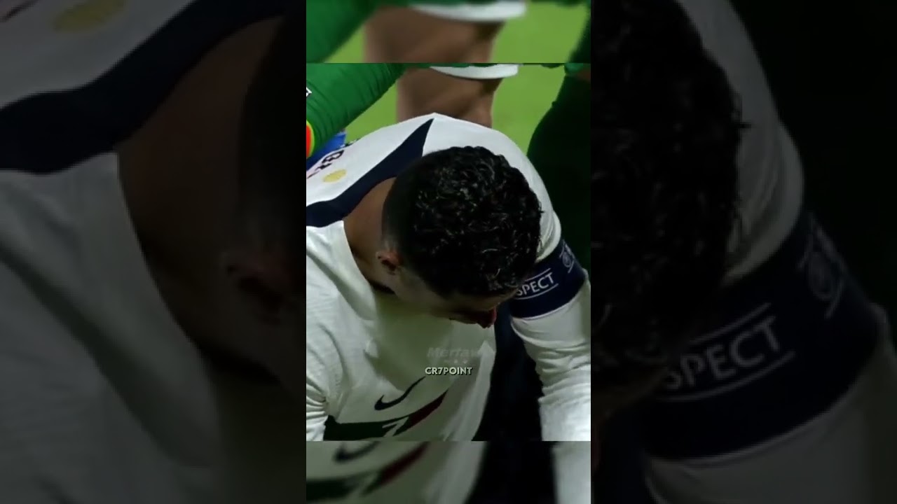 Ronaldo nose injury today #shorts - YouTube