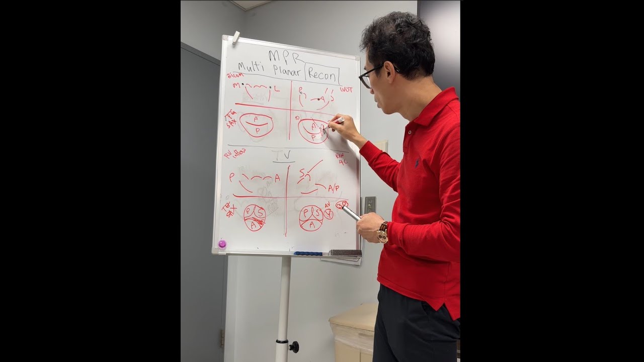Whiteboard Lecture: TEE 3D Multiplanar Reconstruction (MPR) in Mitral ...