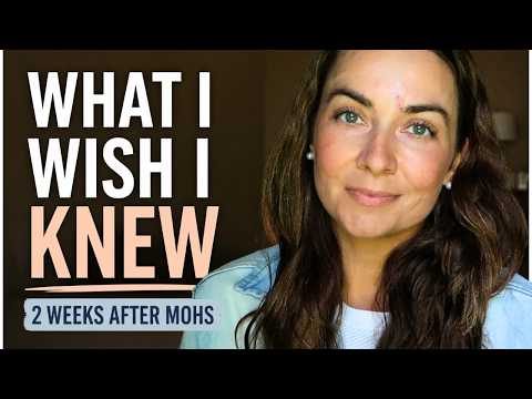 MOHS Surgery 2 Weeks Later 😳 | Scar Reveal + What I Wish I’d Known