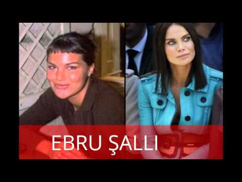 Ünlülerin Estetikten Önceki Ve Sonraki Hallerini Gösteren 14 Çarpıcı Fotoğraf