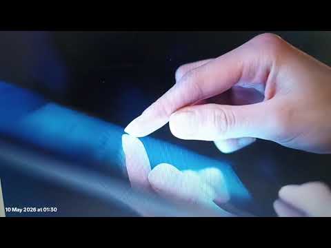 Synaptics Moisture Rejection Technology for Touch Controllers