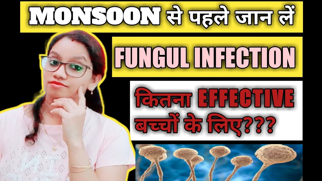 "FUNGUL INFECTION" Is It Dangerous For Our Kids?? जाने इस VIDEO में 👆 ...