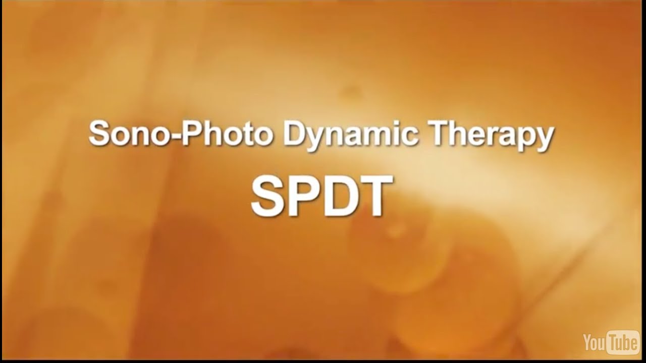 SonoDynamic Therapy for Cancer Treatment - YouTube