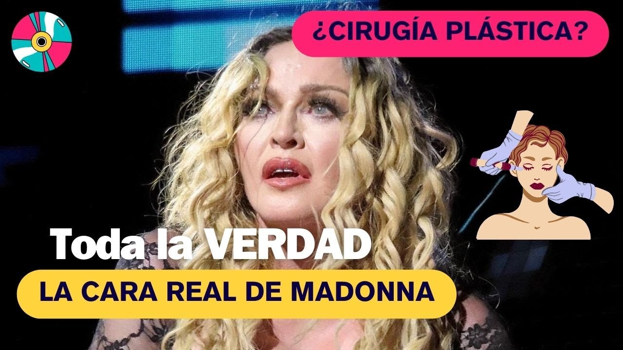 CIRUGÍA PLÁSTICA: La nueva cara REAL de Madonna - YouTube