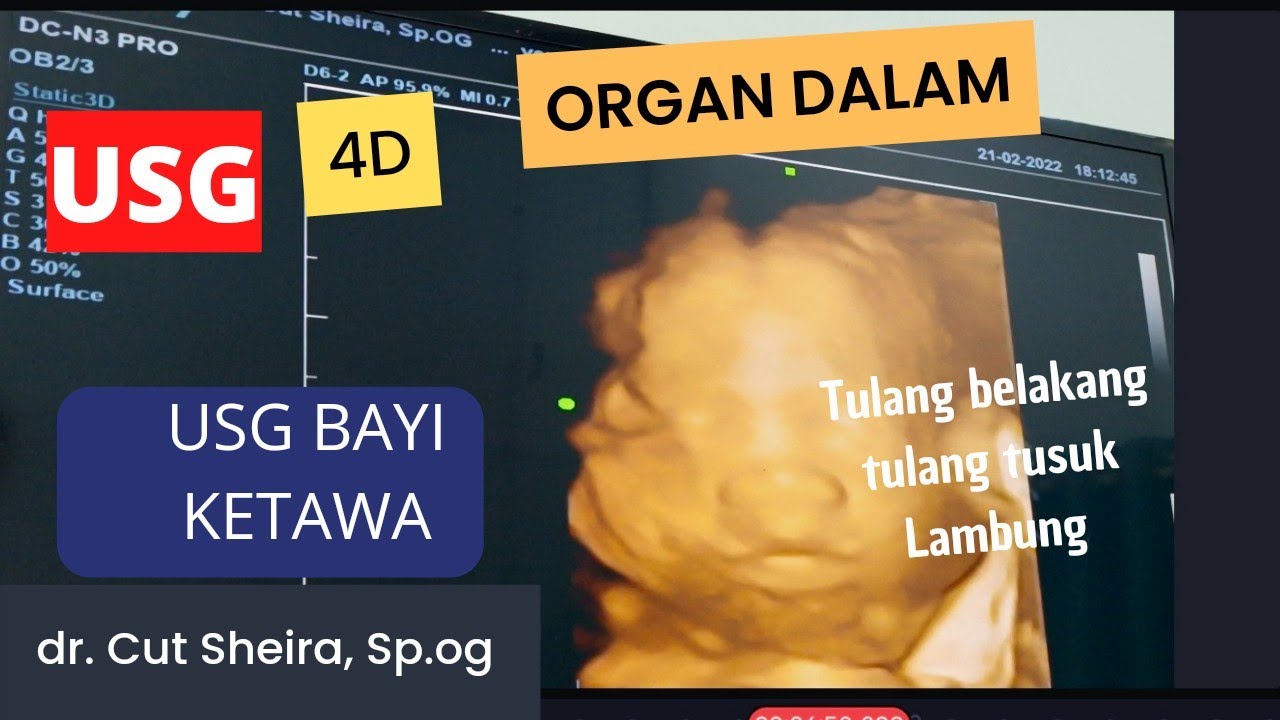 HASIL USG 4D ORGAN DALAM JANIN LENGKAP | KESERUAN USG 4D 28 MINGGU PART 2 - YouTube