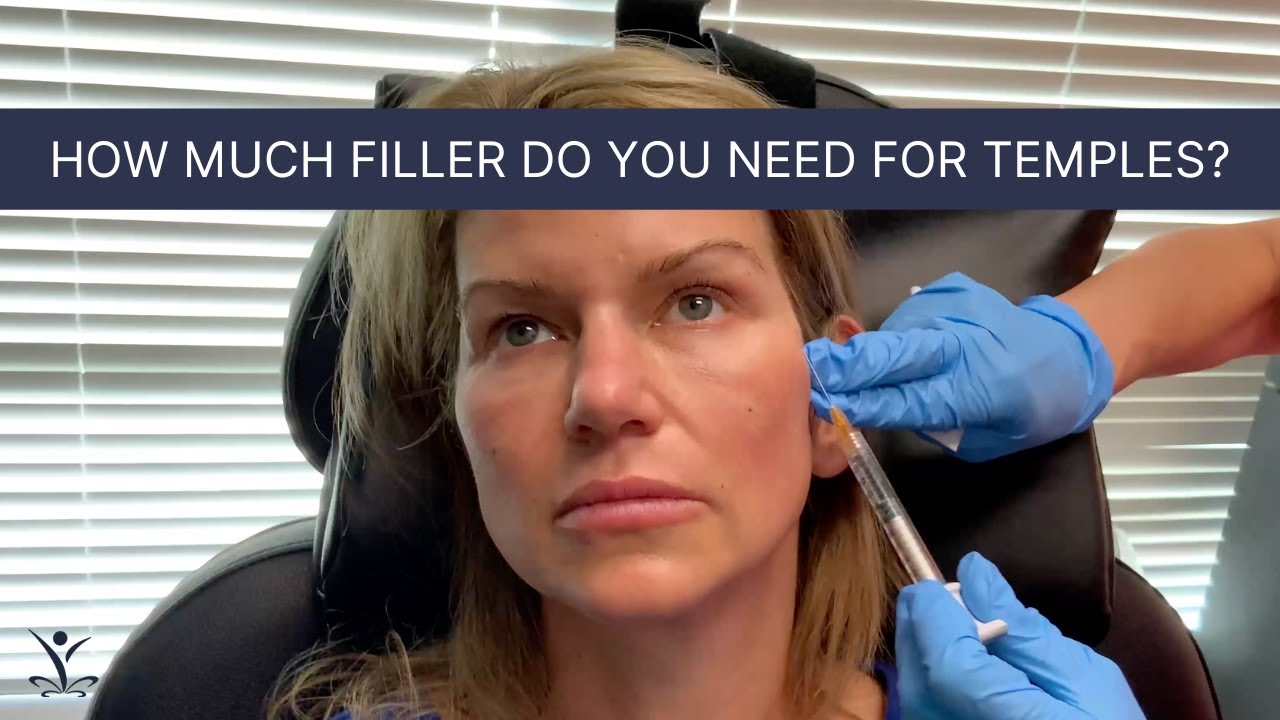 Voluma Temple Filler Can Last for 2 Years (Or More!) - YouTube