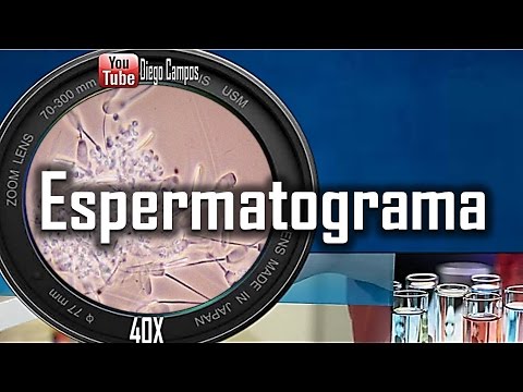 Espermatograma in-fertil- Fertilidad masculina - YouTube