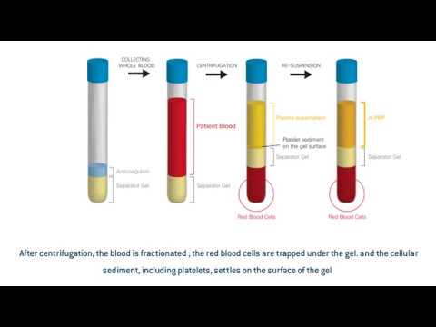 RegenKit® A PRP® Protocol Video - YouTube